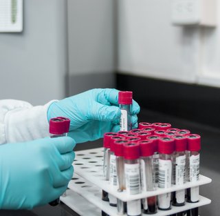 Tests to diagnose APL | Blood Cancer UK